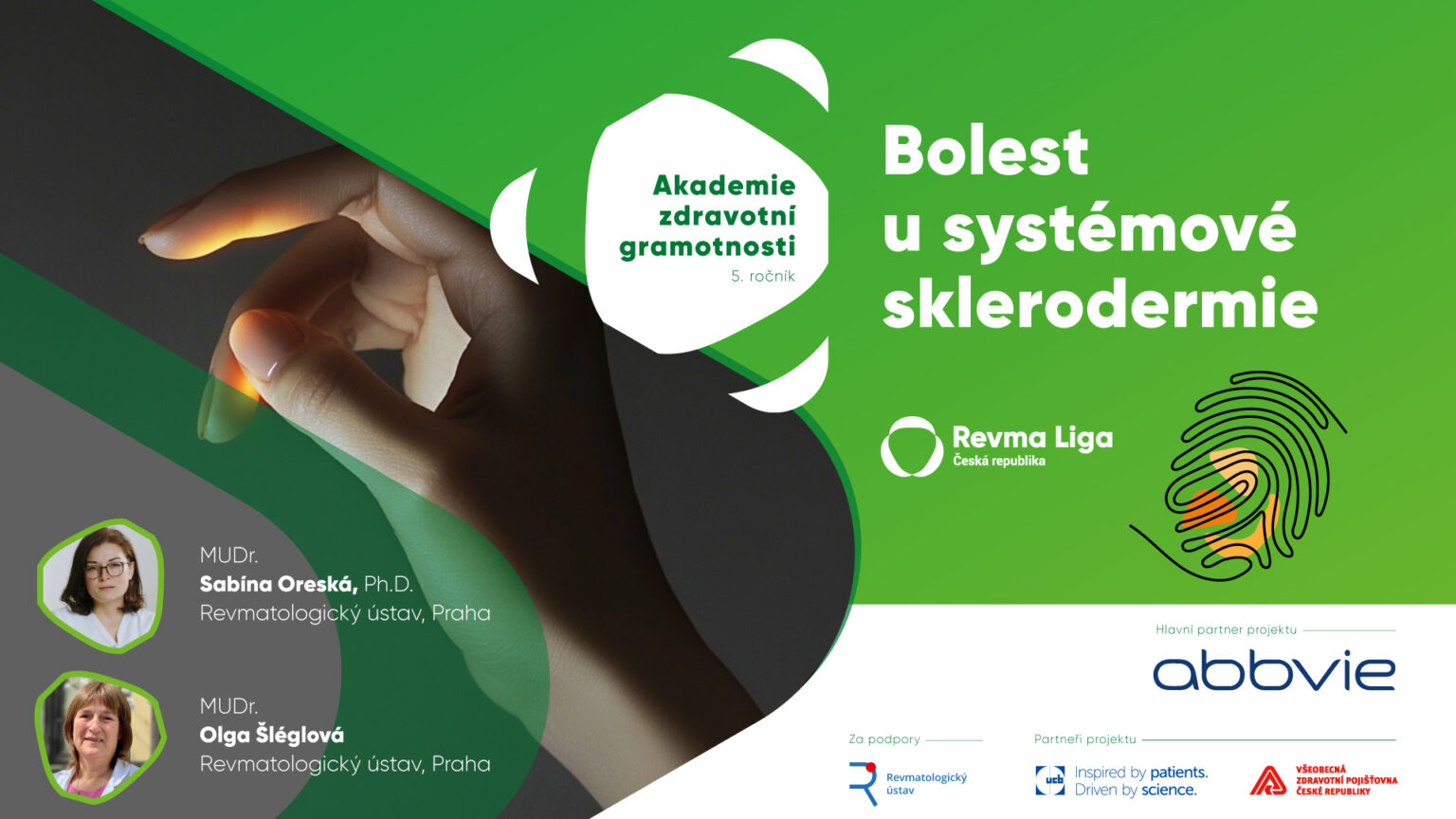 Systémový lupus erythematodes (SLE) - Revma Liga Česká republika, z.s.